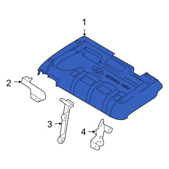 Hyundai Elantra Custom Engine Covers – CARiD.com